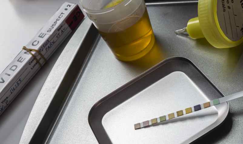 How Long Does Weed Stay in Your System Urine Test? - International ...